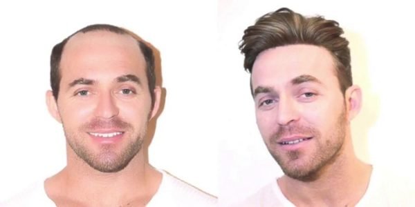 Le complément capillaire pour homme - Look Homme